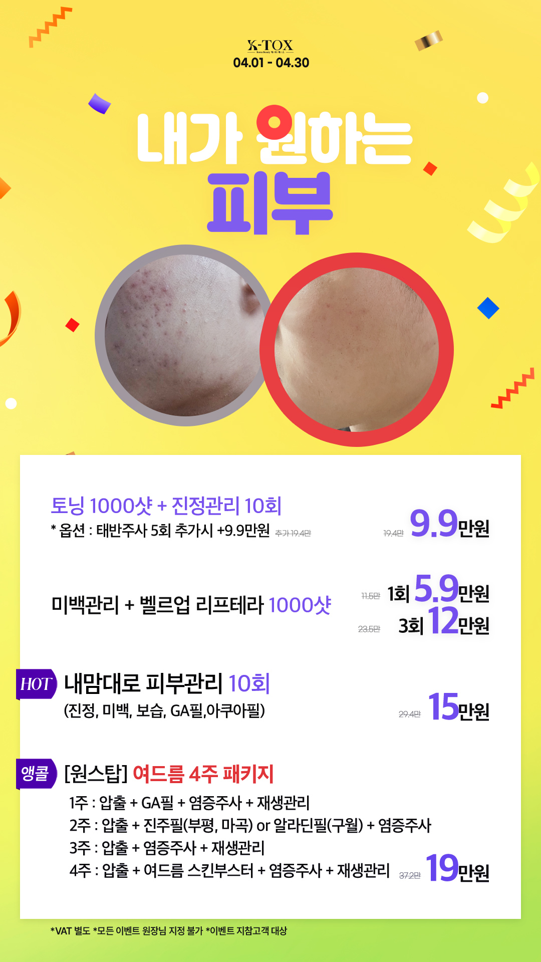 케이톡스의원 Brand > Event > 초특가 이벤트
